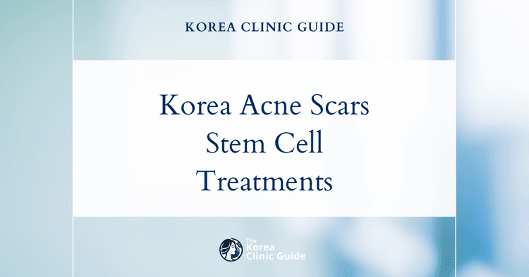 Korea Acne Scars Treatment: Advanced Stem Cell Acne Scar Procedures for ...