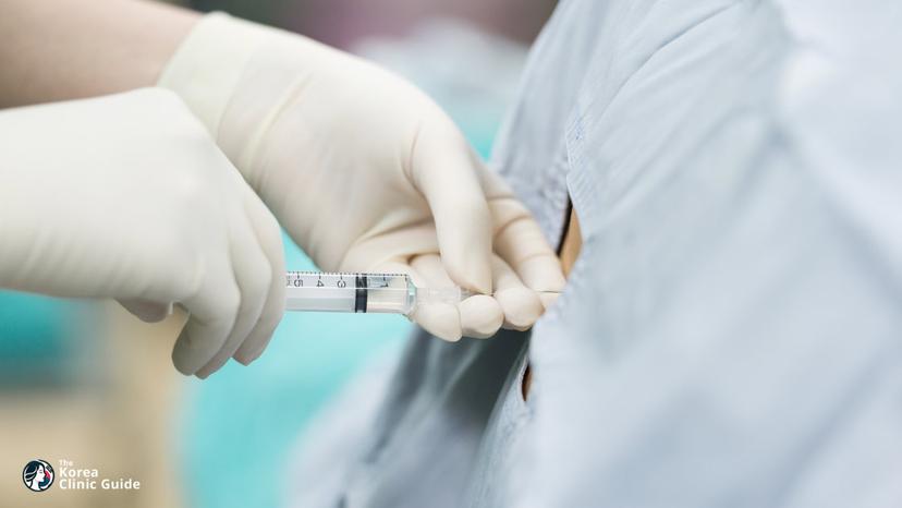 Nerve Block Procedure in Korea | Best Clinics, Costs, Procedure Types ...