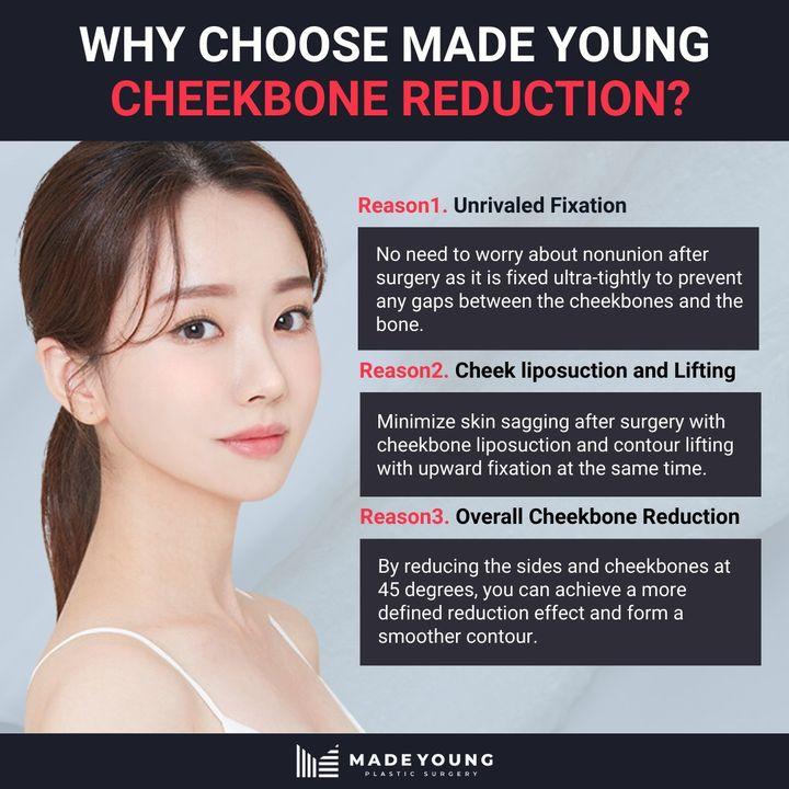 Asymmetrical Cheekbones Correction with Cheekbone Reduction Surgery in ...