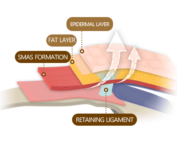 Sun Damage Face Sag Solutions: Face Lift Procedures in Korea for ...