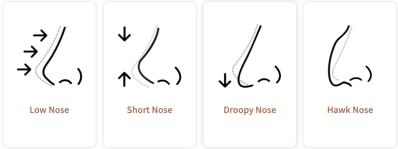 Cost of a Nose Job in Korea (Seoul) | Price of All Types of Nose Jobs ...